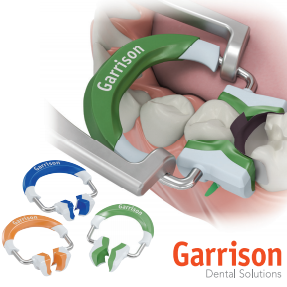 Garrison Case Study by Dr. Andrea Fabianelli | DentSupplier